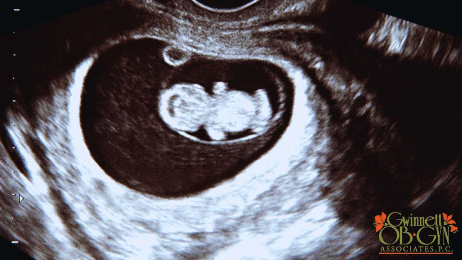 Fetal Testing Benefits for Moms and Babies | Gwinnett OB/GYN