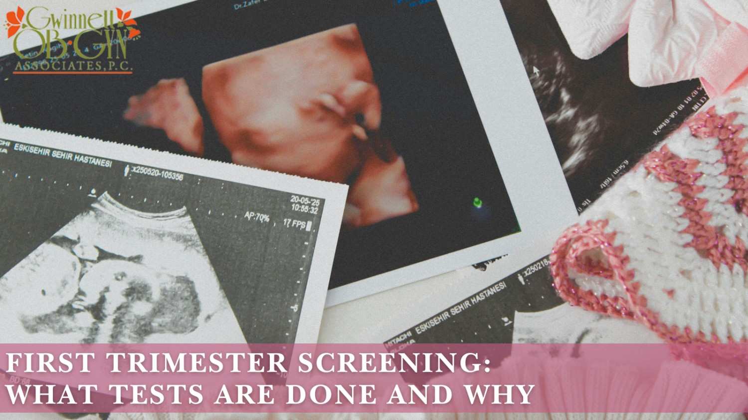 Erstaunlich First Trimester Screening Ebenbildnull